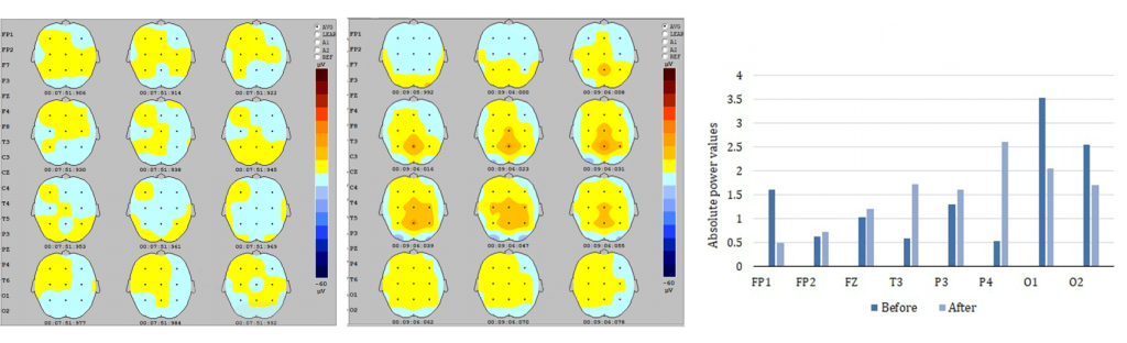 How to naturally unlock the brain's potential? The strength of CurQfen ...